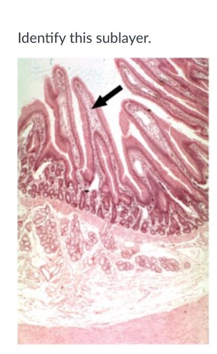 Solved Identify this sublayer. | Chegg.com
