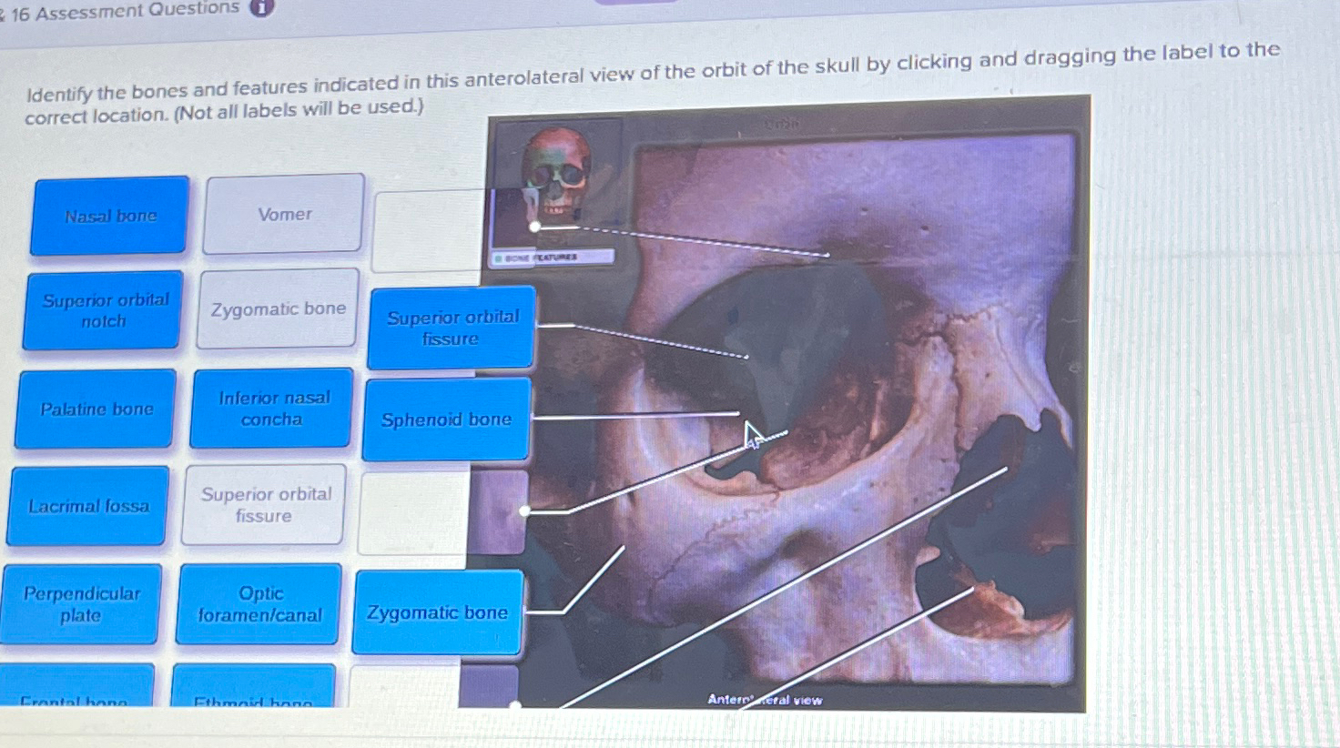 Solved 16 ﻿Assessment QuestionsIdentify the bones and | Chegg.com