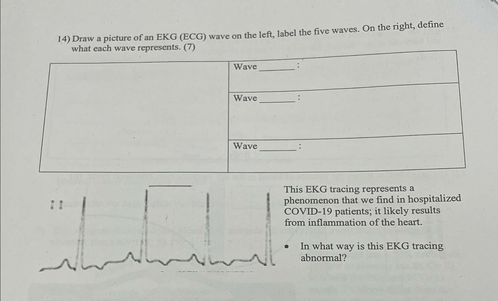Solved Draw a picture of an EKG (ECG) ﻿wave on the left, | Chegg.com