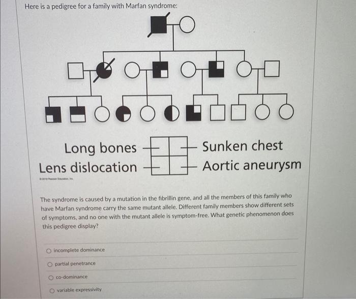 Solved Here is a bedigree for a familv with Marfan syndrome: | Chegg.com