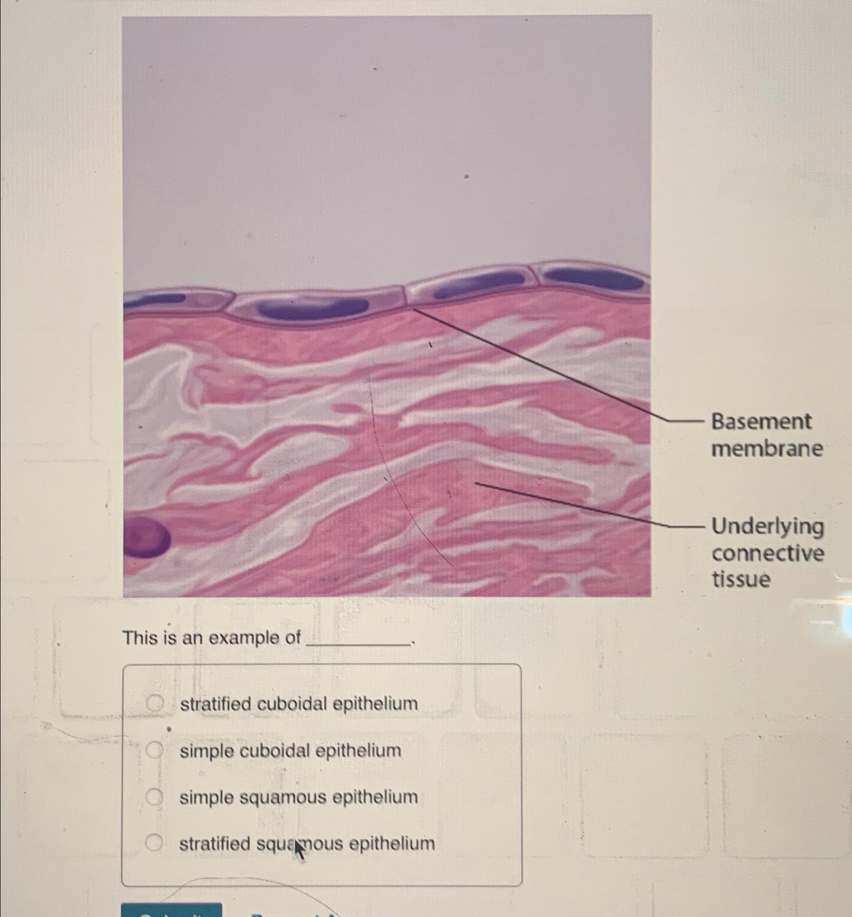 Solved This is an example ofstratified cuboidal | Chegg.com