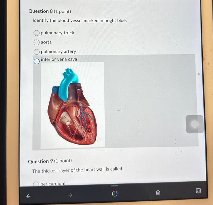 Solved Identify the heart structure in bright blue: | Chegg.com