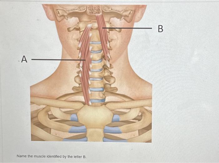 Solved Name the muscle identified by the letter B. | Chegg.com