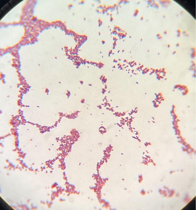 Solved list the possible bacterial microorganisms on the | Chegg.com