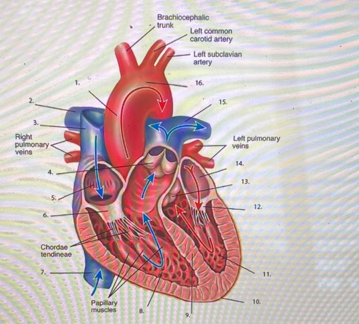 Solved Brachiocephalic trunk Left common carotid artery Left | Chegg.com