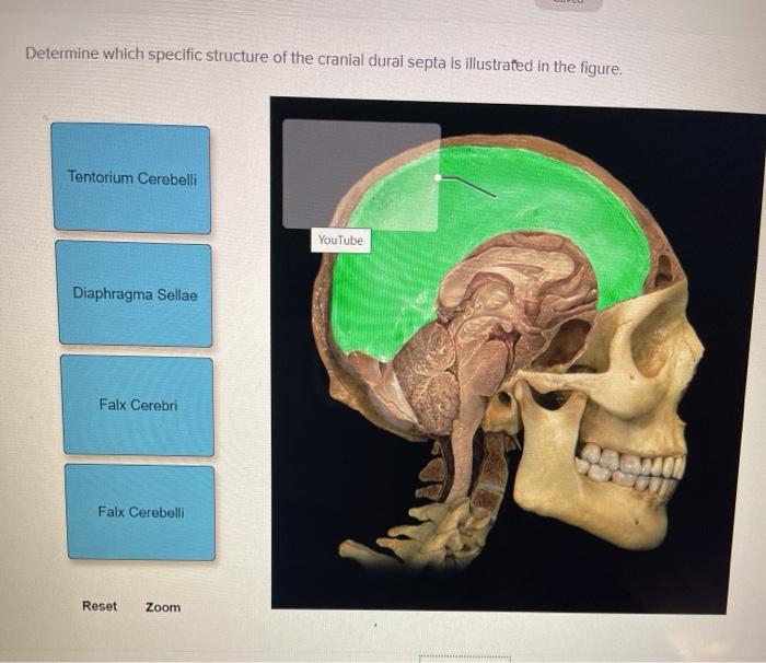 Solved Determine which specific structure of the cranial | Chegg.com
