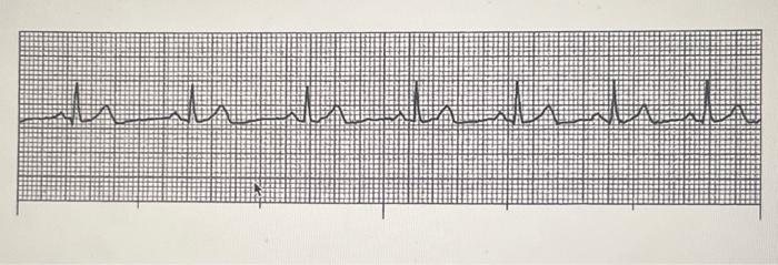 Solved 1 .ventricular Rate /Rhythm---- Atrial Rate / | Chegg.com