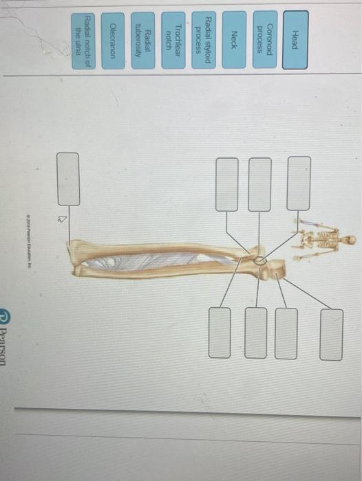 Solved Head Coronoid process INI III Neck Radial styloid | Chegg.com