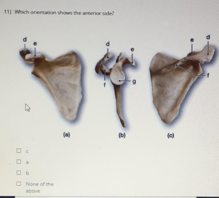 Solved 11) Which orientation shows the anterior side? 9 (a) | Chegg.com