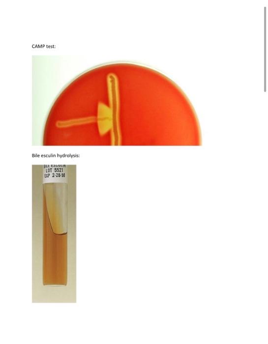 Solved Identify The Following Streptococci The Following