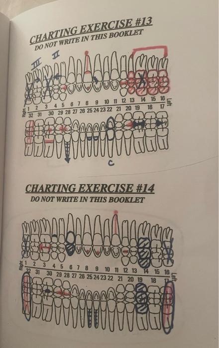 CHARTING EXERCISE \#13 CHARTING EXERCISE \#14 DONOT | Chegg.com