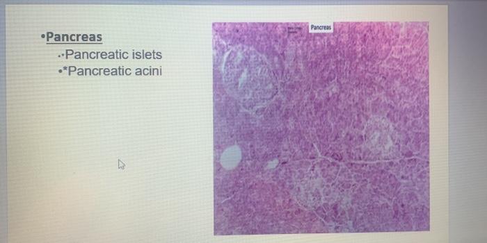 Solved Pancreas Pancreas Pancreatic islets **Pancreatic | Chegg.com