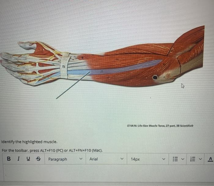 Solved TVA 16: Lite Site Muscle Torso, 27.port, 38 | Chegg.com