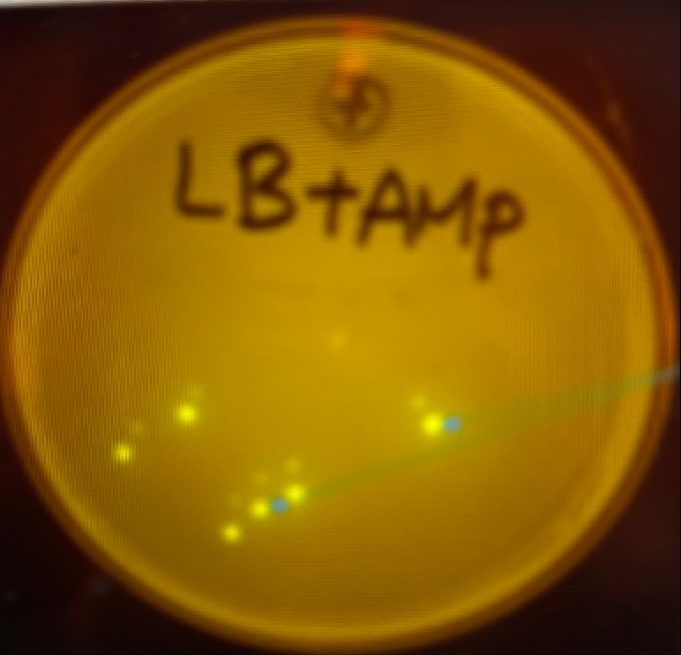 Solved LB ﻿AMP Why are there so few colonies on this plate? | Chegg.com