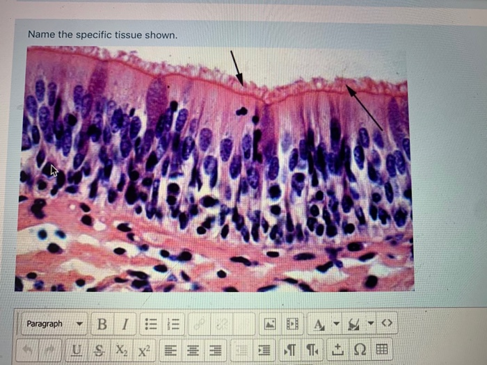 Solved Name the specific tissue shown in the top layer of | Chegg.com
