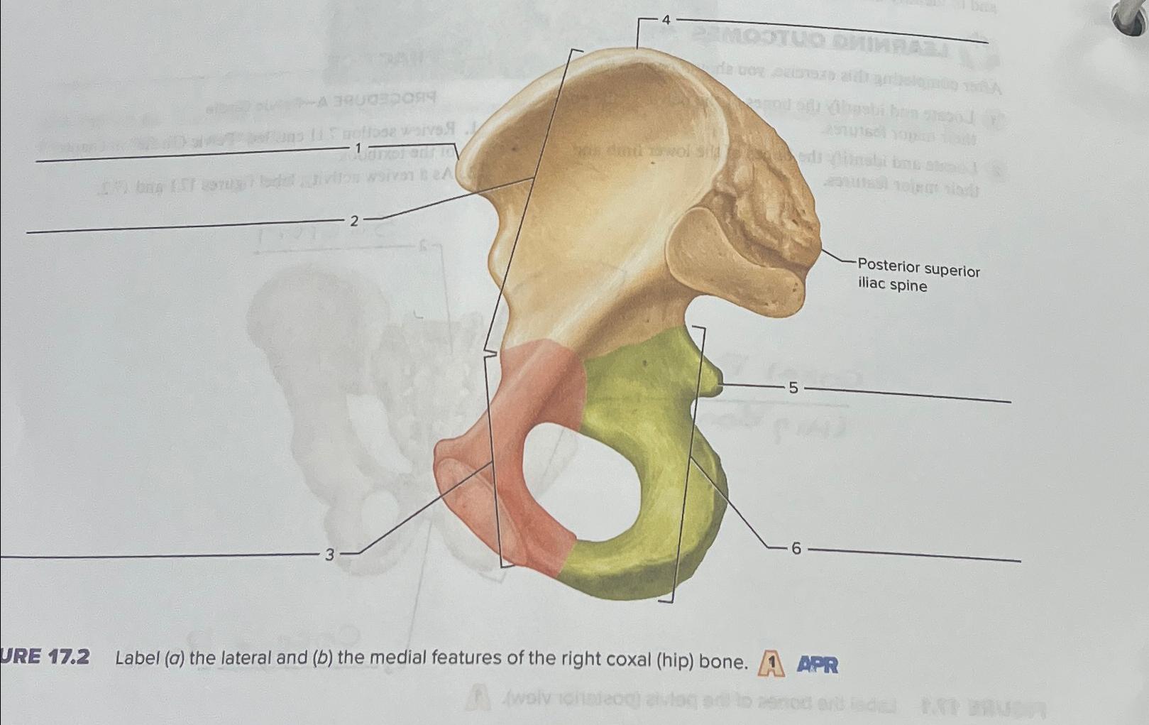 Solved URE 17.2 ﻿Label (a) ﻿the lateral and (b) ﻿the medial | Chegg.com