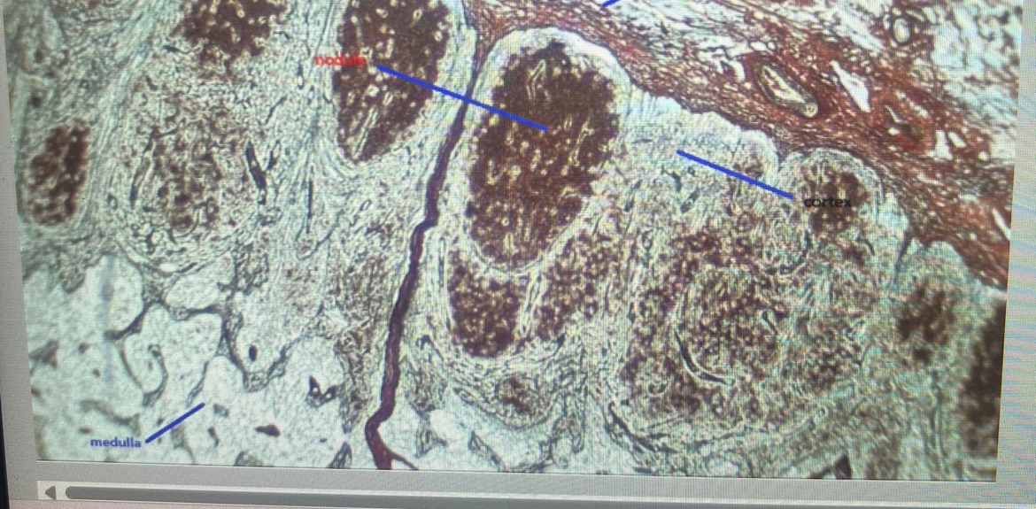 Solved Please labelbthe capsule, medulla, cortex and nodule | Chegg.com