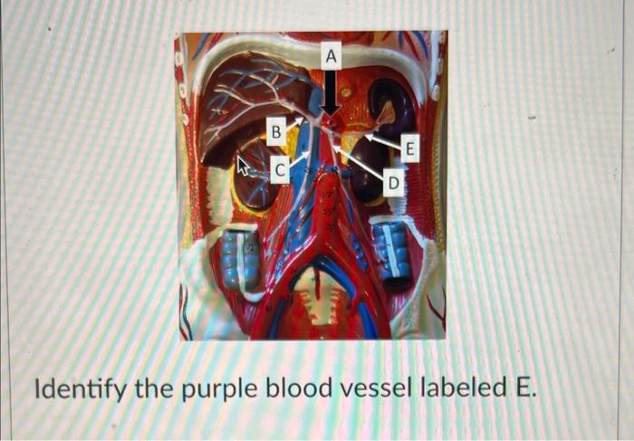 Identify the purple blood vessel labeled E. | Chegg.com