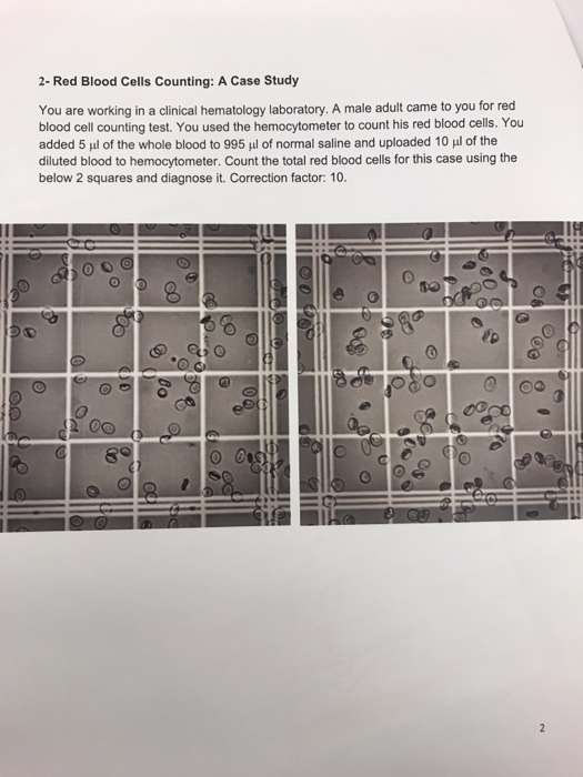 Solved 2- Red Blood Cells Counting: A Case Study You are | Chegg.com
