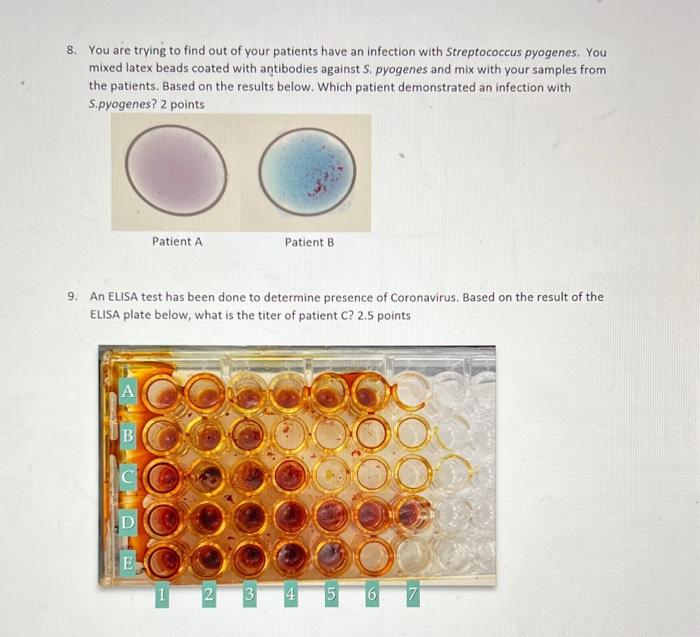 Solved 8. You are trying to find out of your patients have | Chegg.com