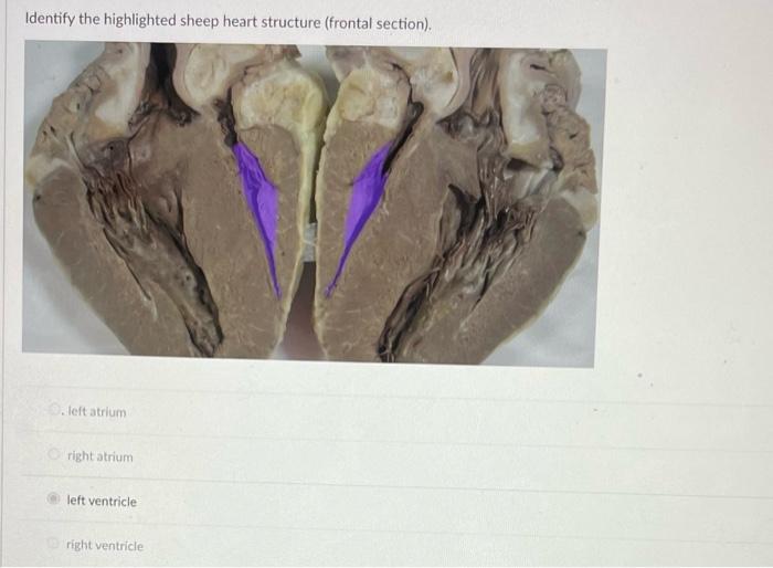 Solved Identify the anatomical feature of the frontal | Chegg.com