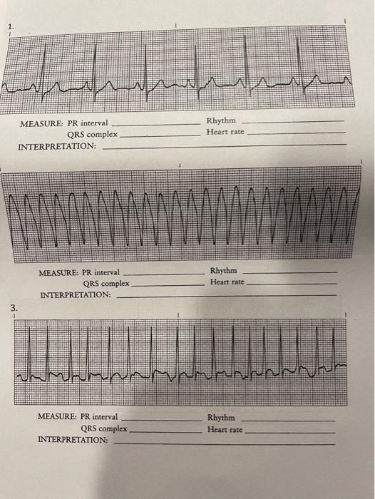 Solved MEASURE: PR interval Rhythm QRS complex Heart rate | Chegg.com