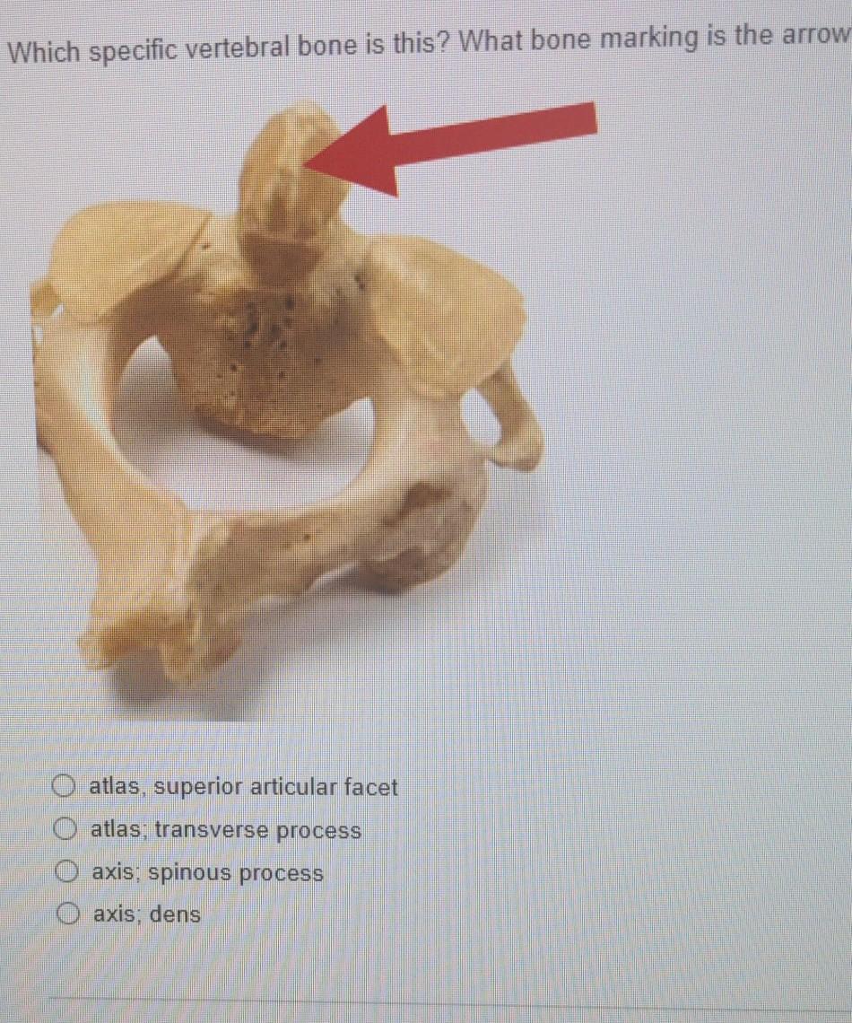 Solved What bone marking is the arrow pointing to in the | Chegg.com