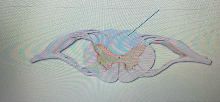 Solved Which structure is highlighted? posterior median | Chegg.com
