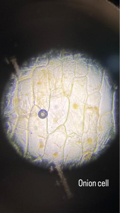 Solved label cell wall, cell membrane, cytoplasmic | Chegg.com