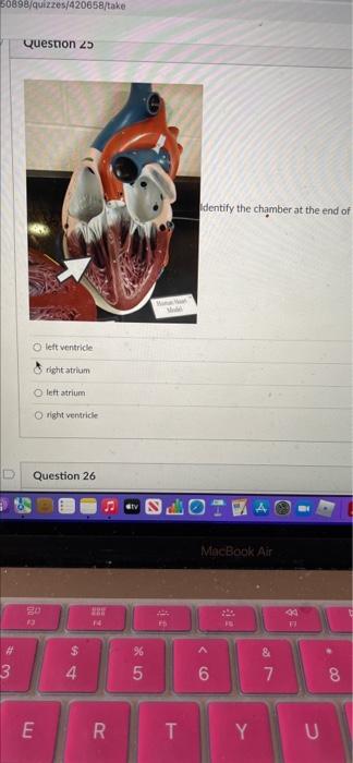 Solved Identify the structure at the end of the pointer. | Chegg.com