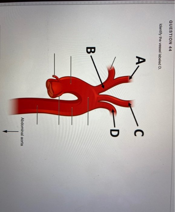Solved Identify the vessel labeled D. -A B Abdominal | Chegg.com
