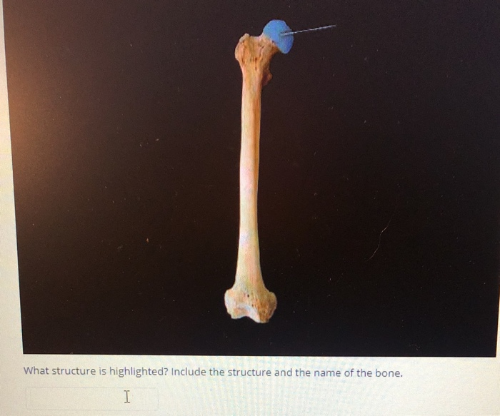 Solved What structure is highlighted? Include the structure | Chegg.com