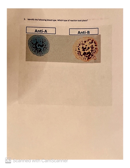 Solved 2. Label the major blood vessels. 2 CS Scanned with | Chegg.com