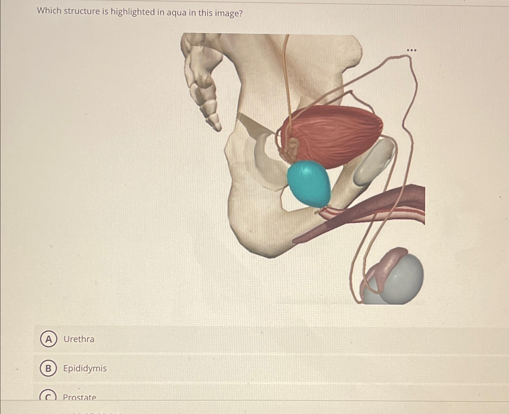 Solved Which structure is highlighted in aqua in this | Chegg.com