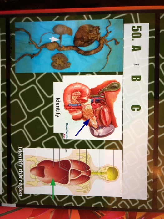 Solved 50. A i B C Heartweb .Net Identify Identify this | Chegg.com