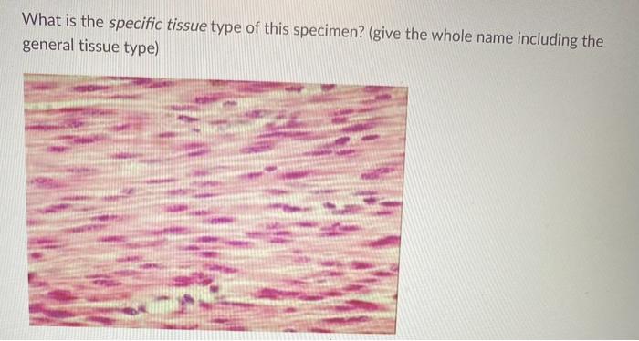 Solved What is the specific tissue type of this specimen? | Chegg.com