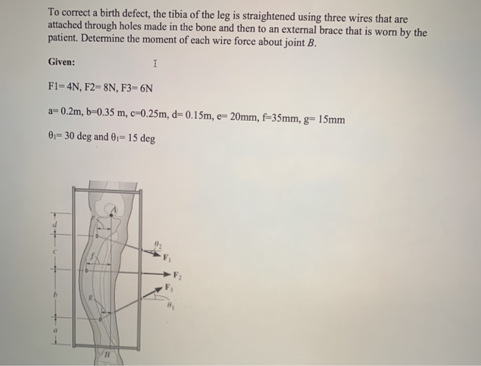 Solved To correct a birth defect, the tibia of the leg is | Chegg.com