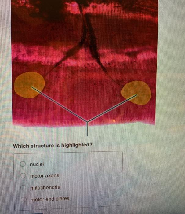 Solved Which structure is highlighted? nuclei U motor axons | Chegg.com