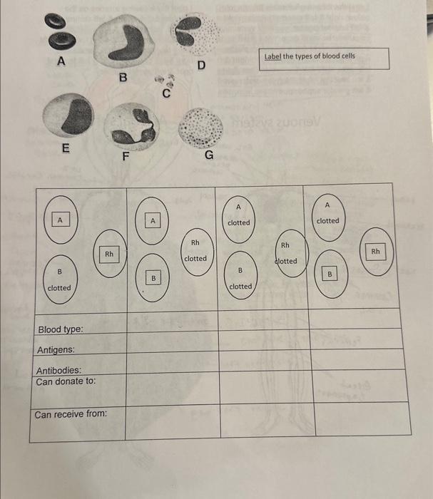 Solved Label the types of blood cells | Chegg.com