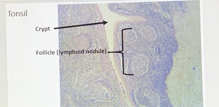 Solved Tonsil Crypt Follicle (lymphoid nodule) { Trachea | Chegg.com