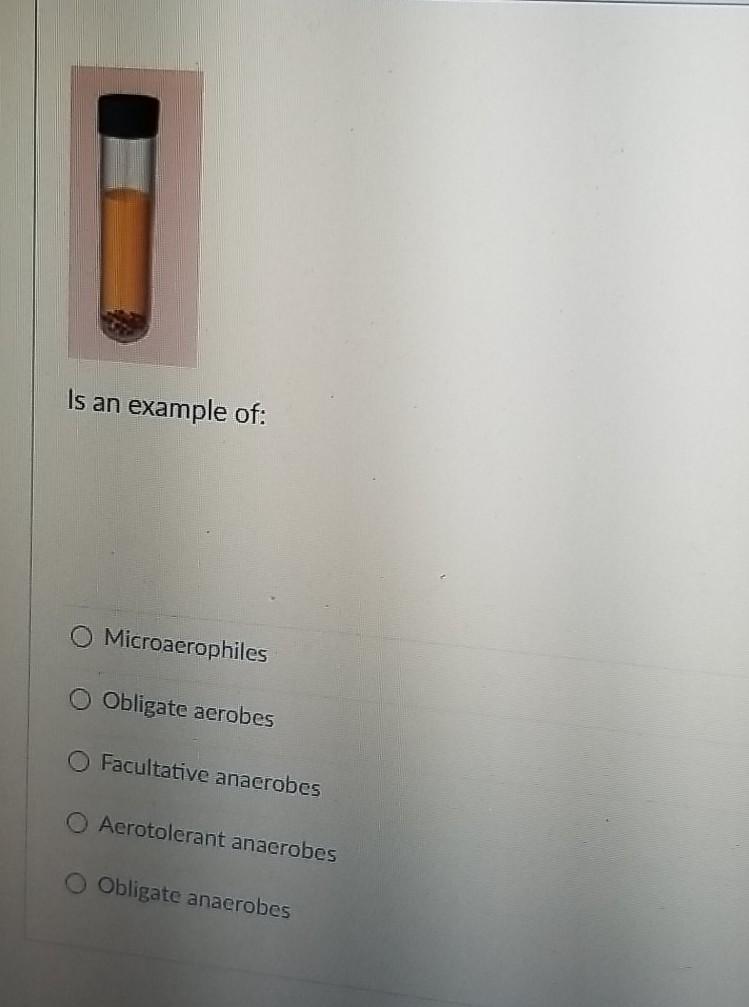 Solved Question 34 Is an example of: Obligate aerobes | Chegg.com