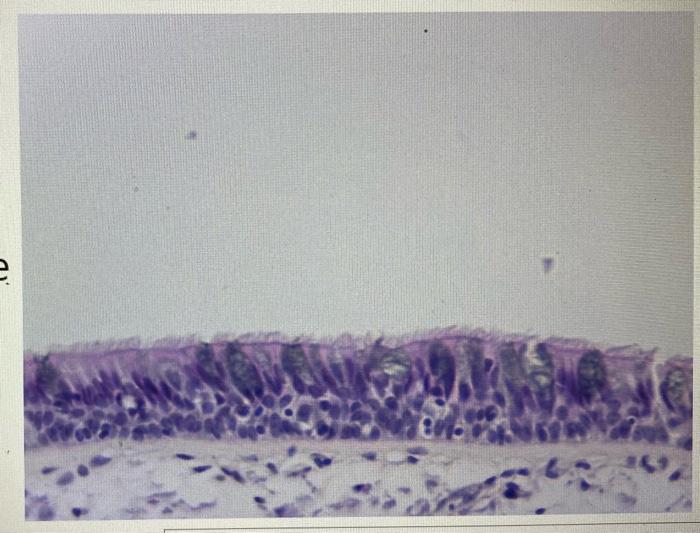 Solved Identify the tissue at the apical surfaces of the | Chegg.com
