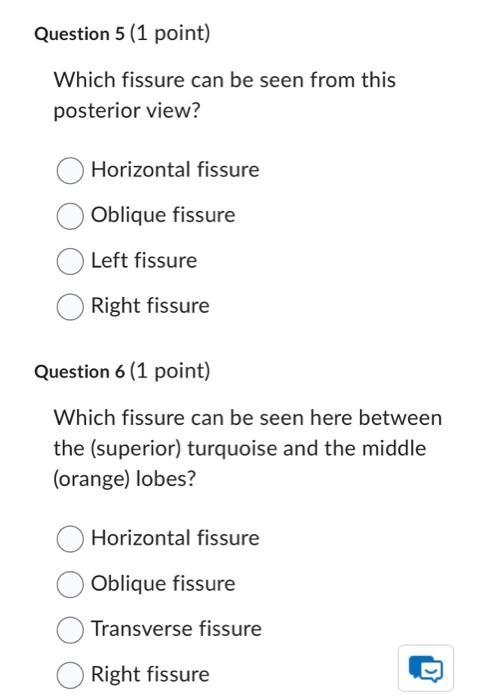 Solved Which fissure can be seen from this posterior view? | Chegg.com