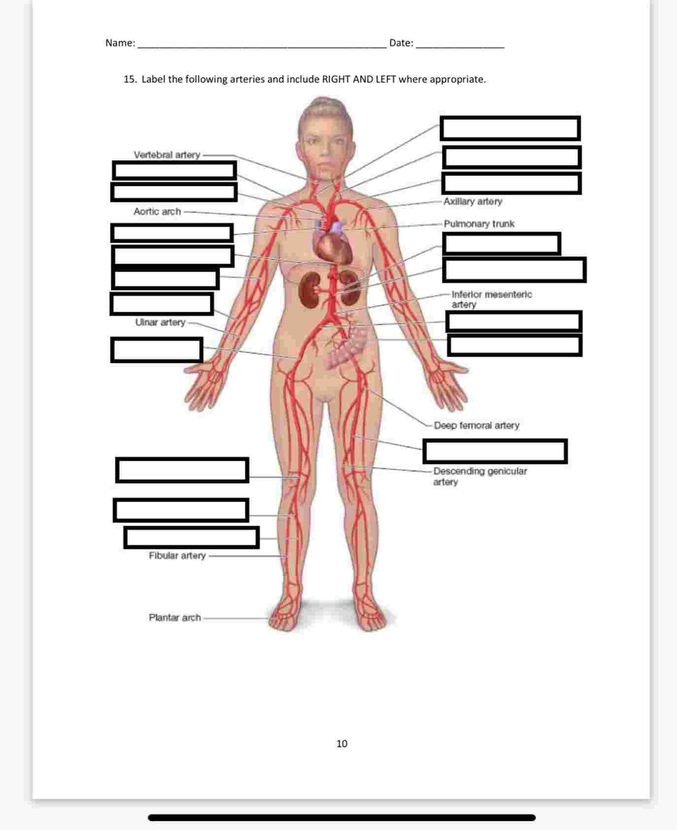 Solved Label the following arteries and include RIGHT AND | Chegg.com