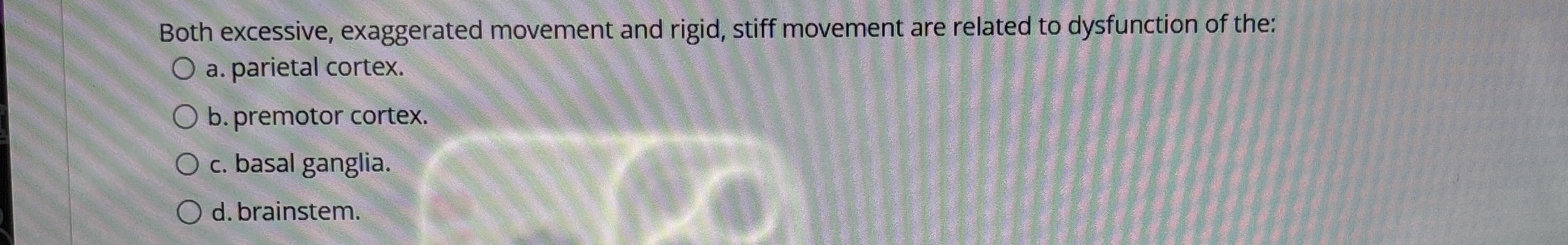 Solved Both excessive, exaggerated movement and rigid, stiff | Chegg.com