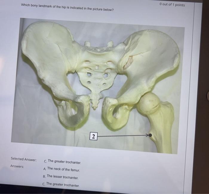 Solved Which bony landmark of the hip is indicated in the | Chegg.com