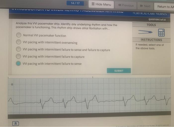 Solved Analyze this Vi pacemaker strip. Identity any | Chegg.com