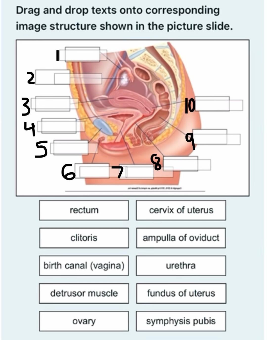 Solved Drag and drop texts onto corresponding image | Chegg.com