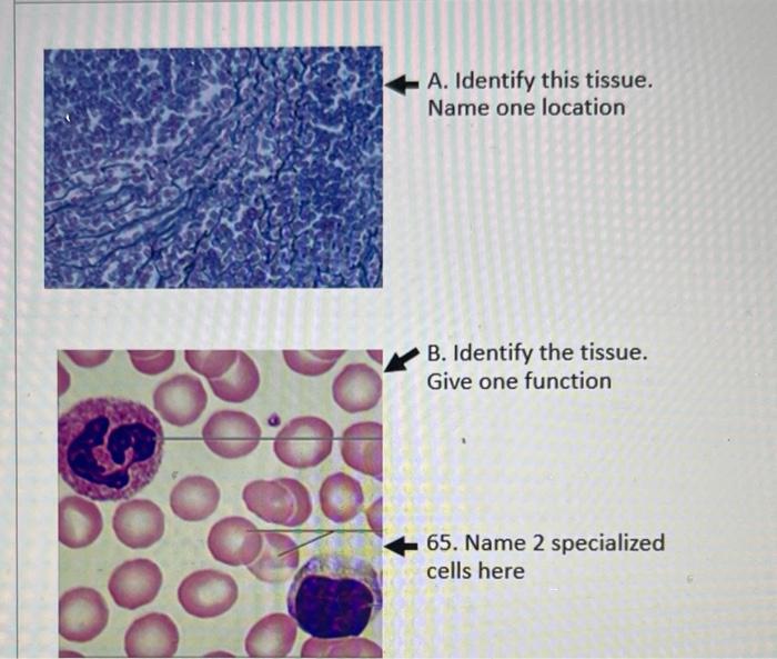 Solved A. Identify this tissue. Name one location B. | Chegg.com