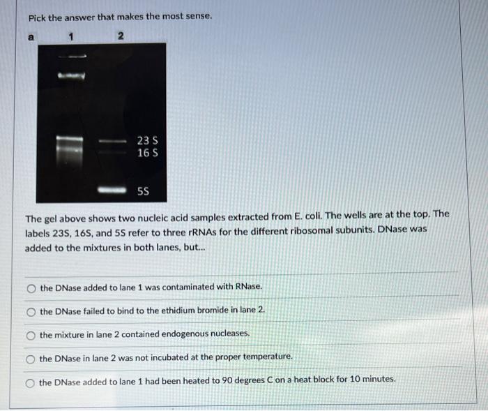 Solved The gel above shows two nucleic acid samples | Chegg.com